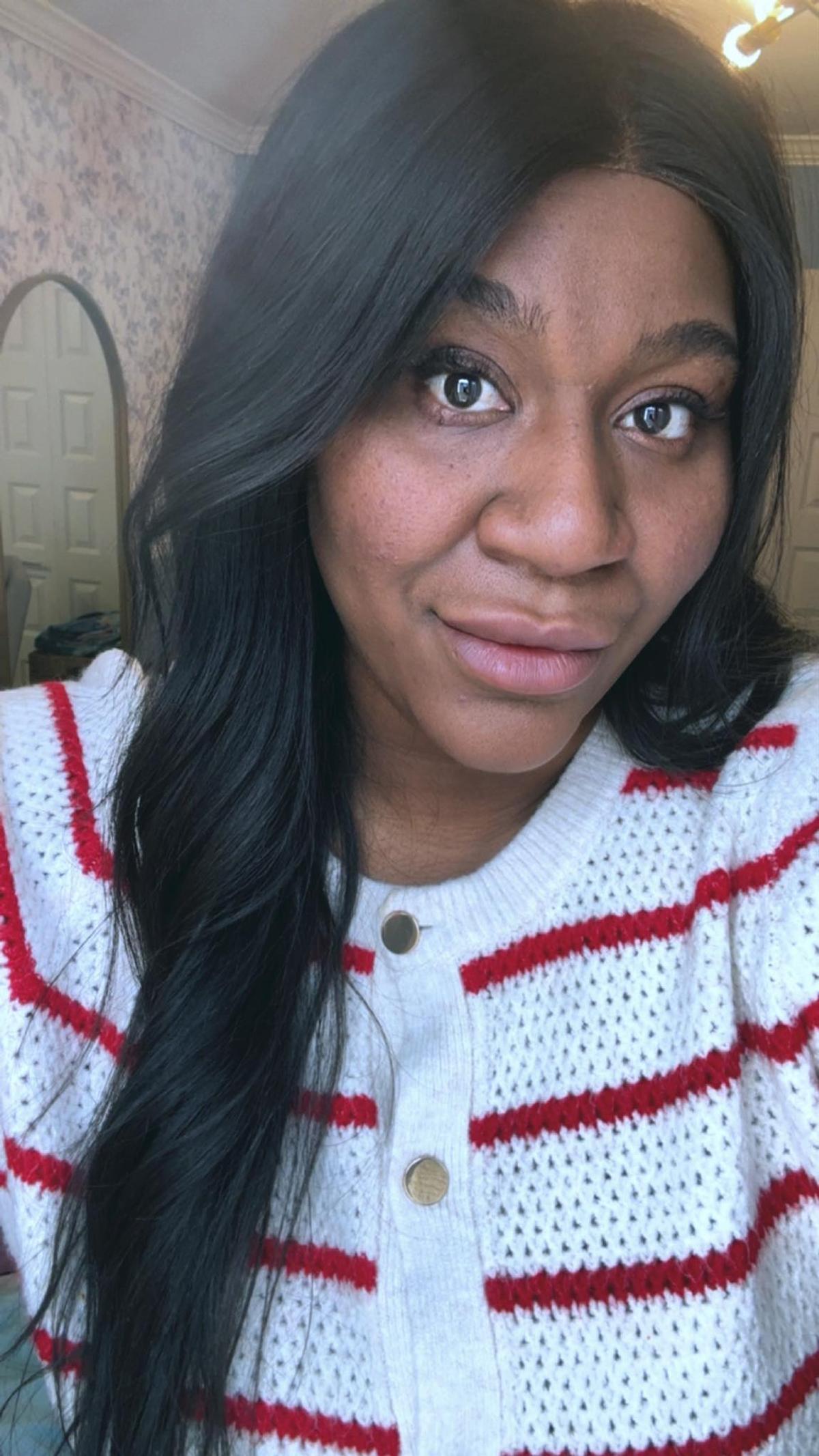 Mélissa Bédard fait le point sur ses problèmes de santé - Monde de Stars