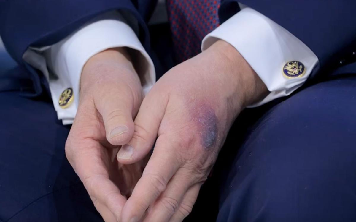 Donald Trump se ridiculise en tentant d’expliquer ce qui est arrivé à ...