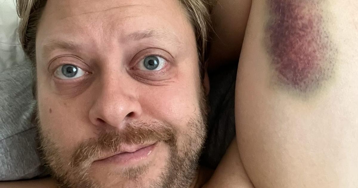 Guillaume Lambert dévoile ses nouveaux tatouages après ses importantes ...